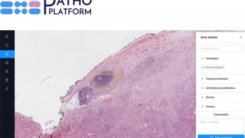Pathoplatform - PathoPlatform and PathoCam, Pathology AI